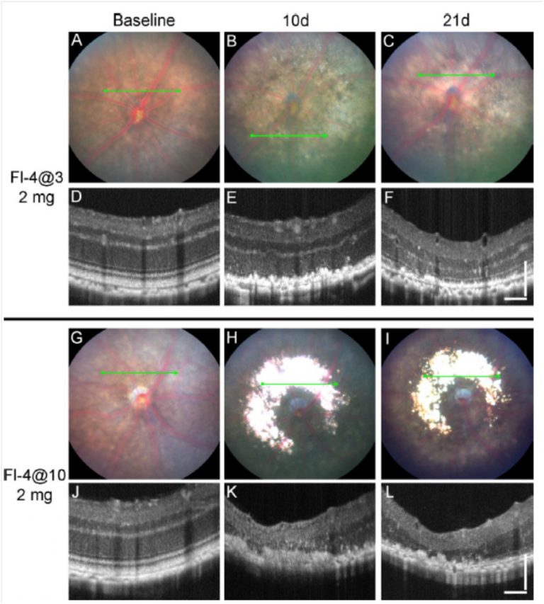 Using MICRON IV to Study Light Induced Retinal Degeneration