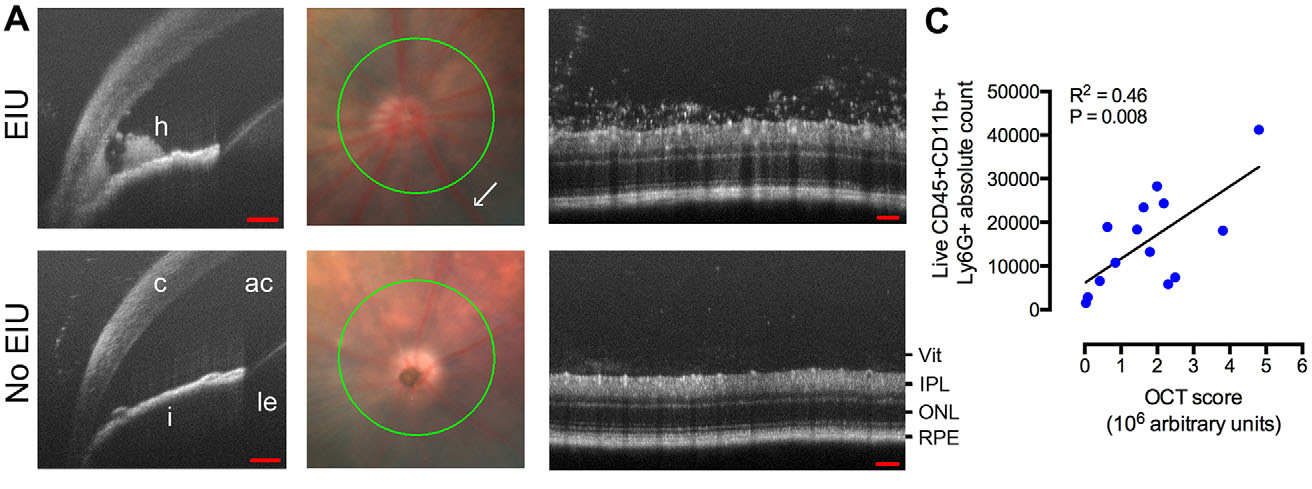 Phoenix OCT reveals detailed images of retinal and anterior chamber ...
