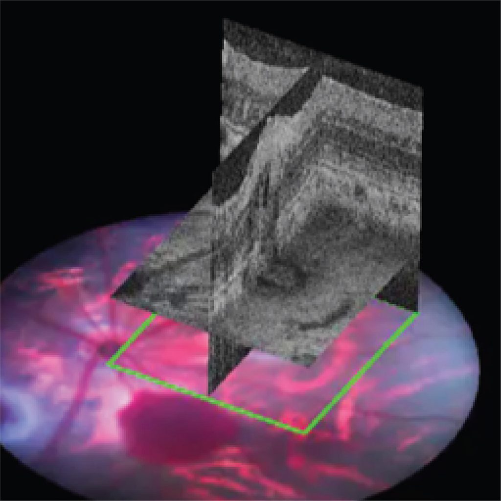 Phoenix MICRON® - Phoenix-Micron