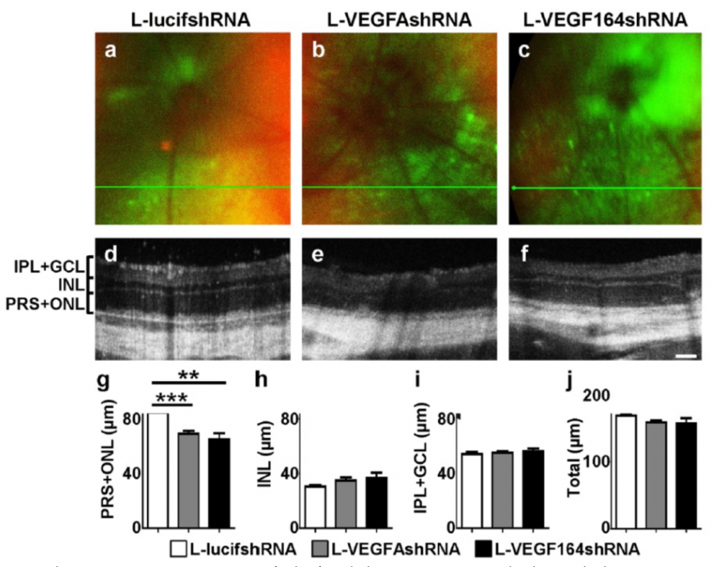Targeting VEGF164 in Müller cells may be useful to treat retinopathy of ...