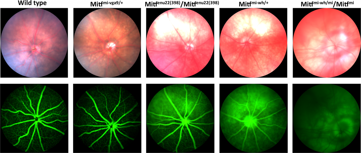 RPE mutations lead to retinal hypopigmentation, vasculature changes ...