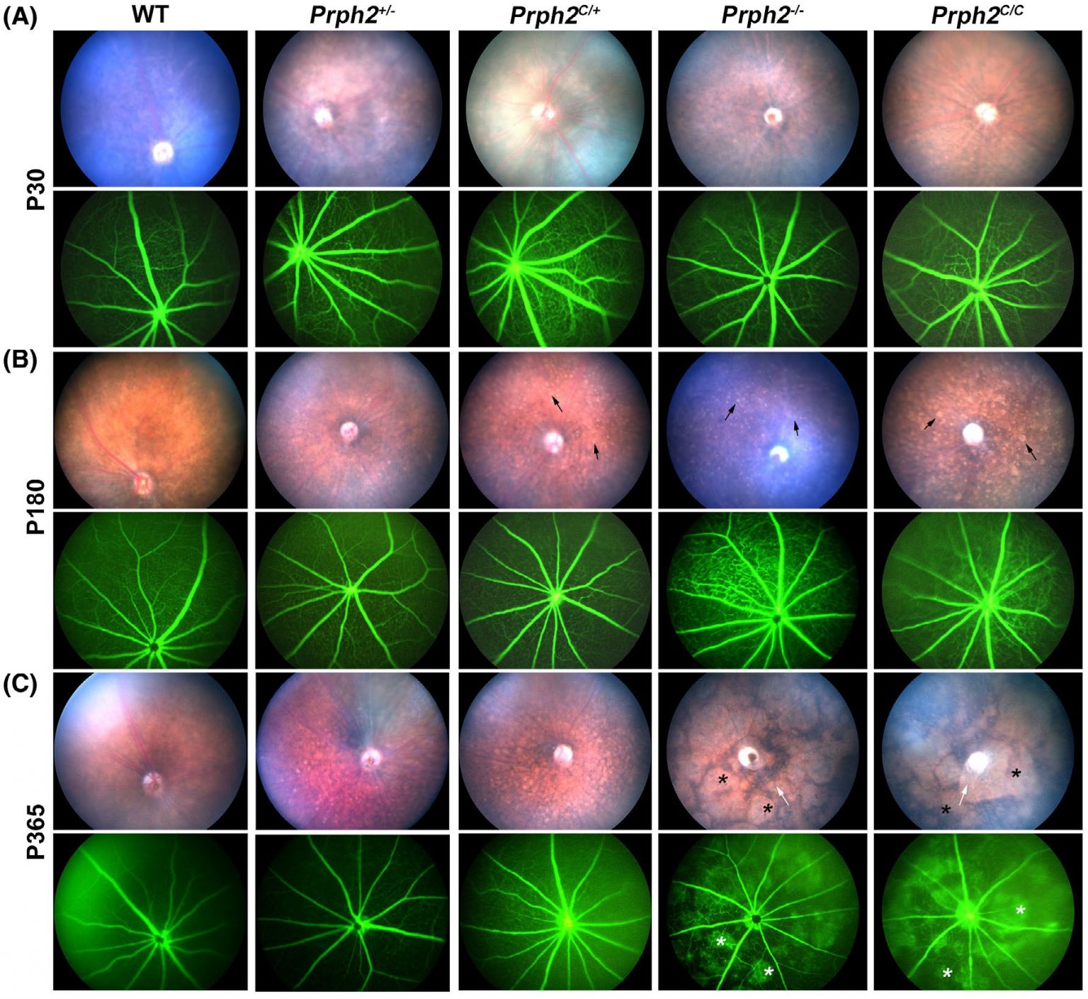 A year-long longitudinal pattern dystrophy fundus study with the ...