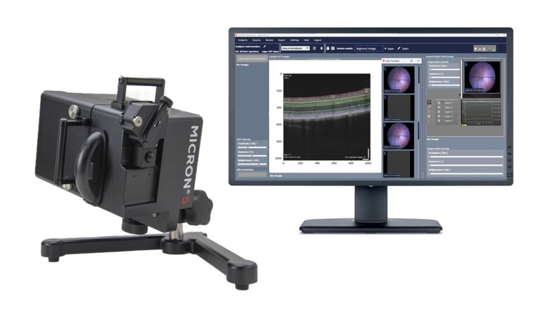 OCT Segmentation - Phoenix-Micron